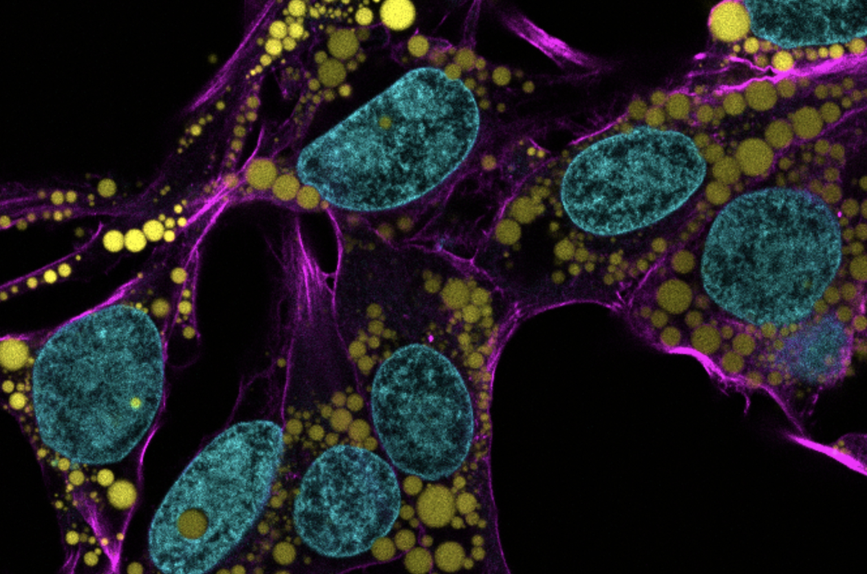 The physics of fat droplets reveal DNA danger | Penn Today