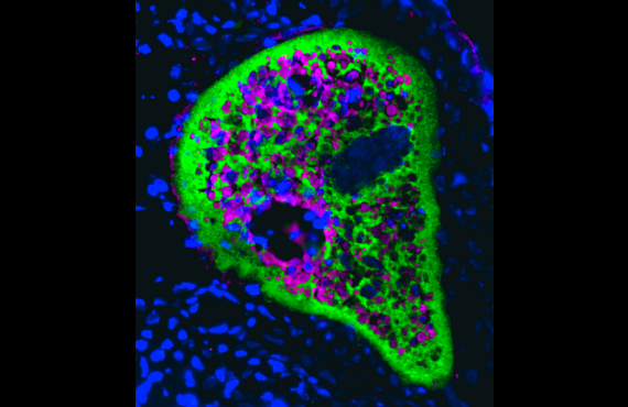 Fish Skin Immune Responses Resemble That of the Gut, Penn Study Finds ...