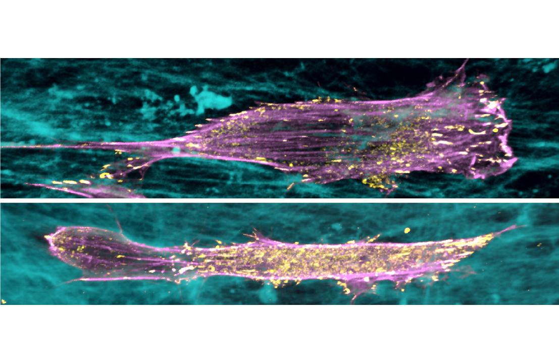 Penn-NIH Team Discovers New Type of Cell Movement in 3D Matrix | Penn Today
