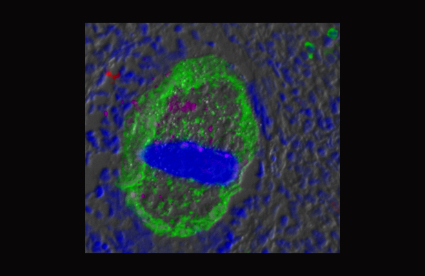 Penn Study Reveals How Fish Control Microbes Through Their Gills | Penn ...