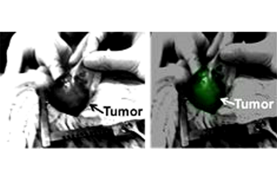 Penn Team Makes Cancer Glow to Improve Surgical Outcomes | Penn Today